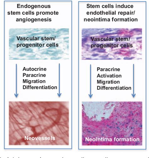 Figure 1 From Stemprogenitor Cells In Vascular Regeneration