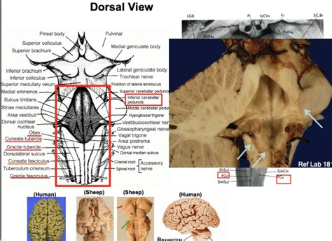 Medulla Dorsal View Diagram Quizlet