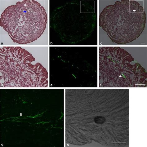 The Neurochemical Properties Of Dil Labeled Drg Neurons Ac