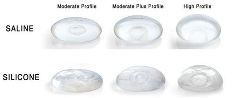 Silicone Breast Implant Safety Gica