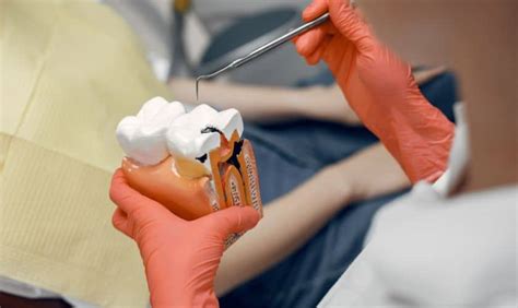Root Canal Or Implant Which Is Better