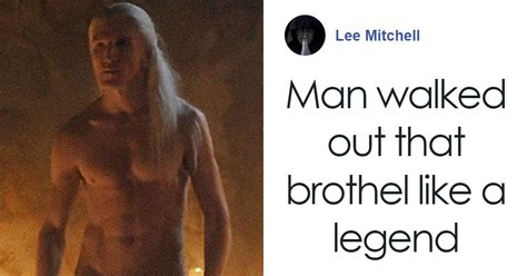 House Of The Dragon Star Reveals He Refused To Use Prosthetic In