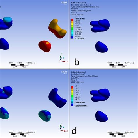 Displacement Patterns And Stress Distributions Of Periodontal Ligaments Download Scientific