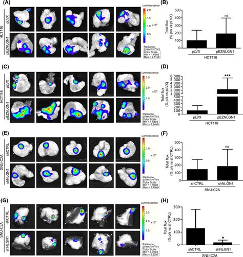 NLGN1 Induces Metastasis Formation By CRC Cells In Vivo 1 5 10 6