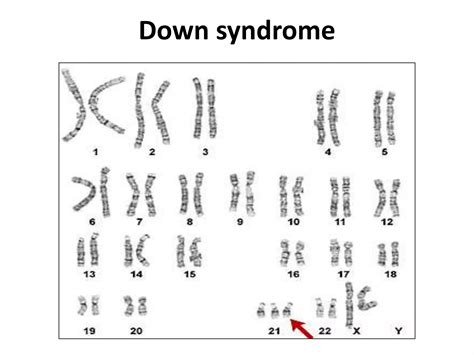 Karyotype And Fish Pptx