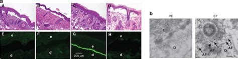 Topical Application Of Rc7 Incorporated Into The Dej Of Rdeb Mouse Skin Download Scientific