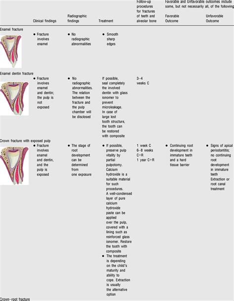Treatment Guidelines For Fractures Of Teeth And Alveolar Bone