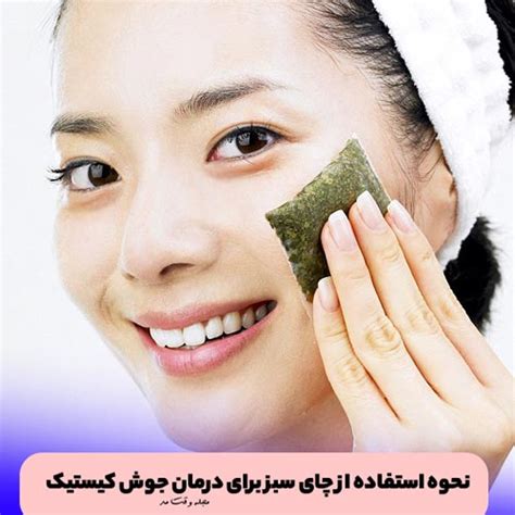 سریعترین روش‎ درمان جوش زیر پوستی😲 مجله وقت مد