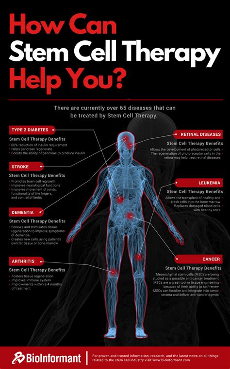 Stem Cell Therapy