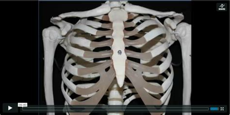 Chest Decompression Smacc Sydney