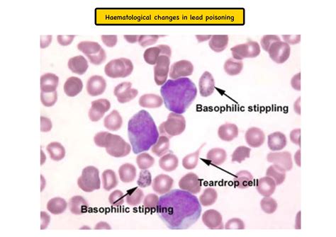 Pathology MCQs For Various Entrance Exams