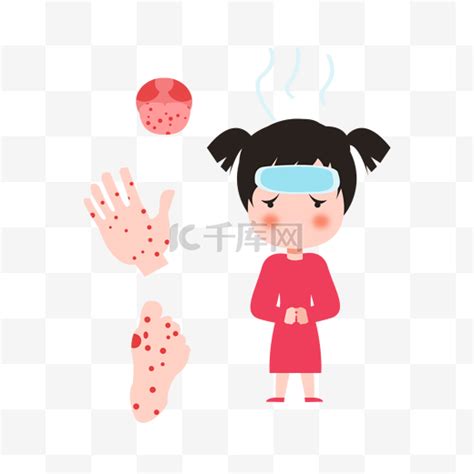 手足糜烂图片 手足糜烂图片素材免费下载 千库网