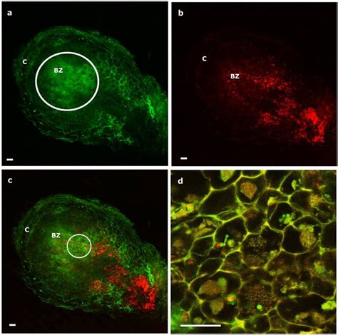 Trifolium Longitudinal Nodule Section 20 Dpi Showing The Distribution Download Scientific