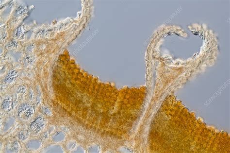 Fungal Rust Lm Stock Image C019 9625 Science Photo Library