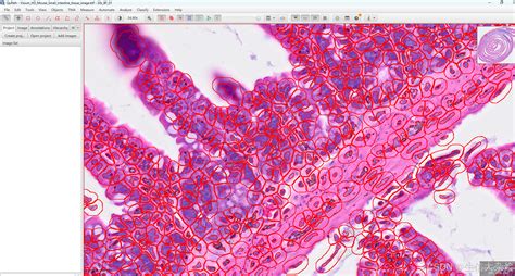 Visium Hd使用cellpose进行细胞分割 补充cellpose3进行细胞分割后从细胞核向外扩展的合理范围 Csdn博客