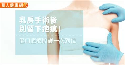 乳房手術後別留下疤痕！傷口疤痕照護一次到位 華人健康網 專業即時優質的健康新聞及資訊分享平台業即時優質的健康新聞及資訊分享平台