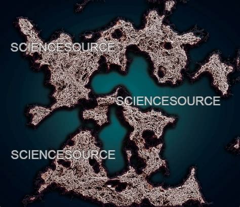 Streptococcus Gordonii Scanning Elect Stock Image Science Source Images