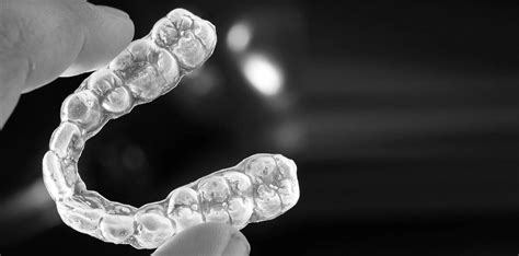 Treatment Process Aligns4u