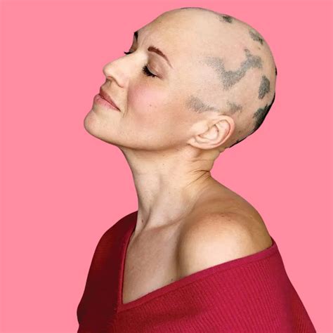 فوركسيجا 10 Mg اقراص