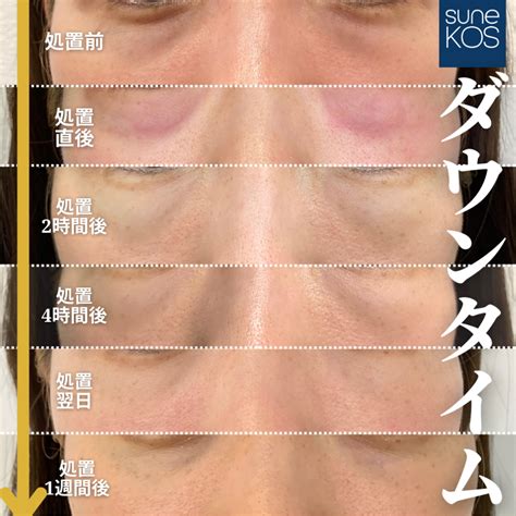 自然なボリュームアップで若々しい印象に 凛クリニック銀座 美容皮膚科（美容医療・美肌治療）
