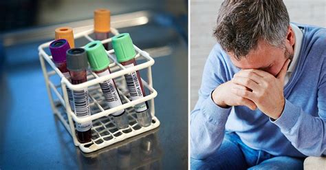 10 000 Män Drabbas Av Prostatacancer Varje år