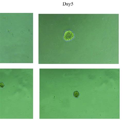 The Growth Of Two Single Spheroids Each In One Well Over 7 Days Some