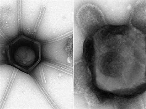 Giant Alien Like Virus Structures With Arms And Tails Found In The Us