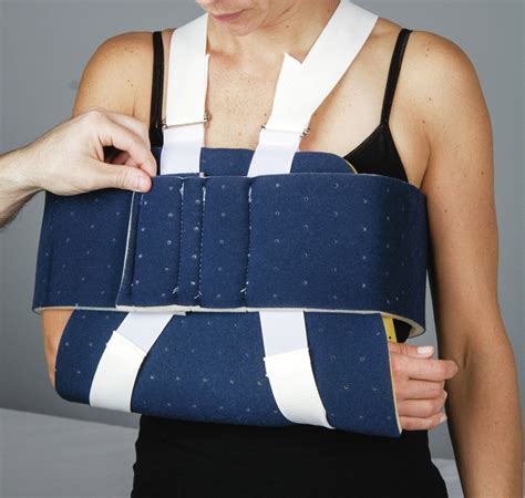 Upper Extremity Splints And Casts Musculoskeletal Key