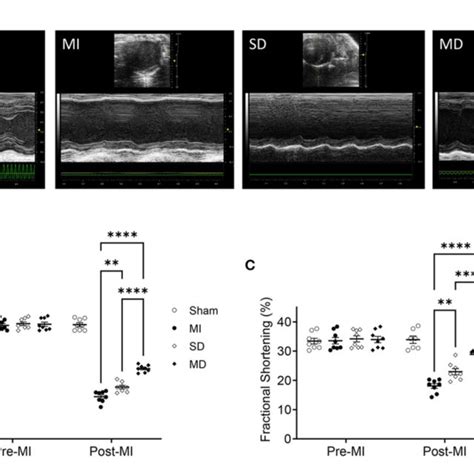 Assessment Of Cardiac Function Use High Resolution Echocardiography