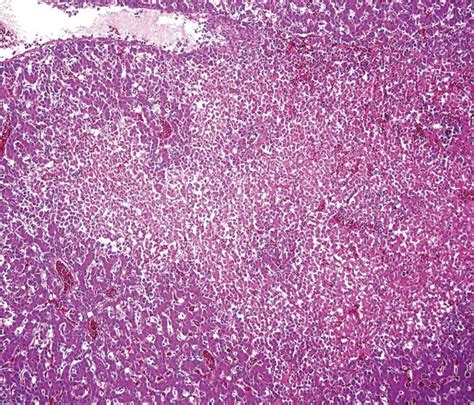 Necrotic Enteritis Of Poultry Veterian Key