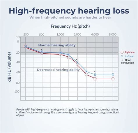 High Frequency Hearing Loss What Is It And How Is It Treated
