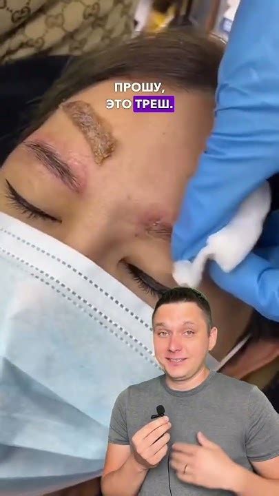 ⭐️Блог про удаление ПМ и тату Подписывайся лазерноеудалениетату перманентныймакияж татуаж