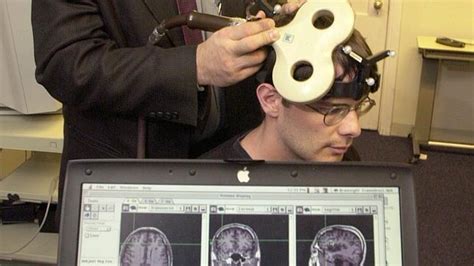 TÉCNICAS DE ESTIMULACION CEREBRAL NO INVASIVA