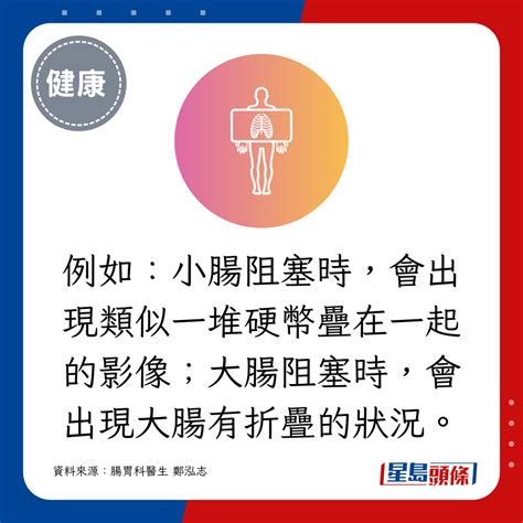 腸鳴原因｜不肚餓但肚子「咕咕叫」揭患大腸癌！伴隨5症狀即求醫 星島日報