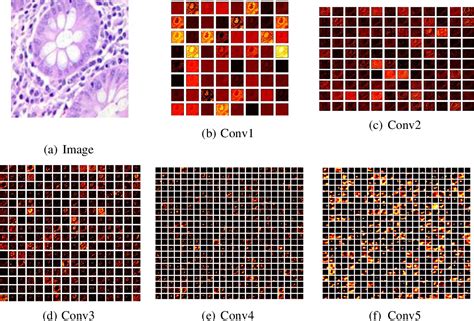 Figure 4 From Colon Histology Slide Classification With Deep Learning Framework Using Individual