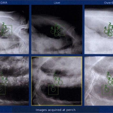 Fiducial Placement Guidance System Example A Screenshot From The Fpgs