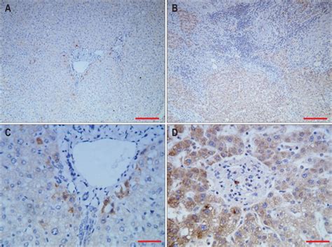 Expression Of Transforming Growth Factor β1 Tgf β1 In Normal And