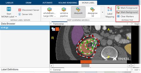 Segment Ct Scan Using Monai Label