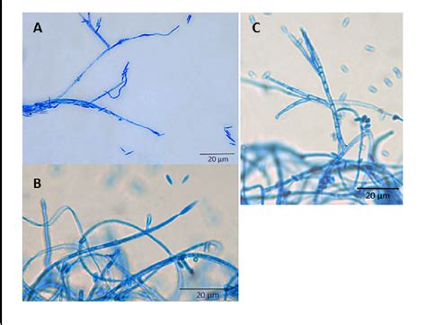Pseudomonas Fuscovaginae Semantic Scholar