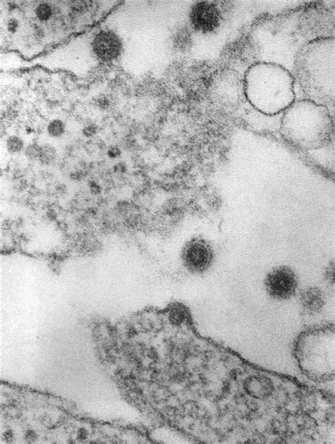 Transmission Electron Micrograph Of Eeev Encyclopedia Mdpi