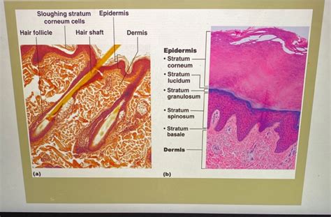 Observe The Slide Of Thick Skin Draw And Label The Chegg Com