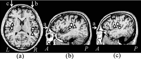 Figure 11 From Real Time Head Localization System For Magnetoencephalography Semantic Scholar