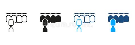 Dental Veneer Human Tooth Care Pictogram Ceramic Teeth Veneers