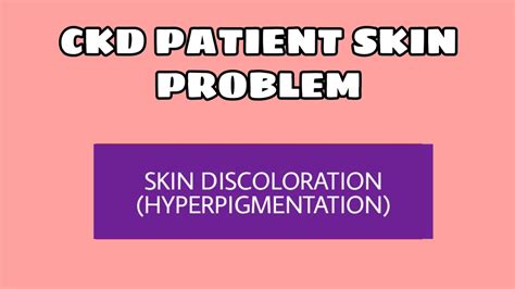 Ckd Patient Skin Problem Last Type Skin Discoloration