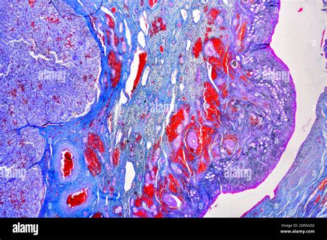 Human Ovary Section Showing Corpus Luteum Stroma Epithelium And