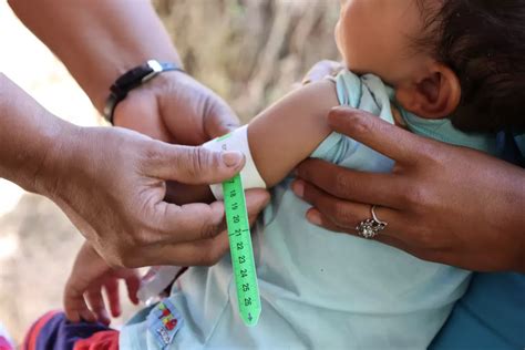 Uno De Cada Cuatro Niños Y Niñas En El Mundo Vive En Situación De