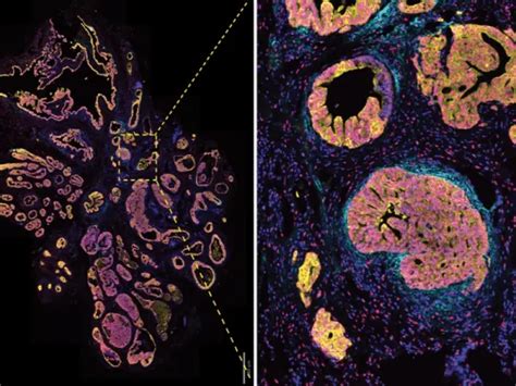 Pathologists Worldwide Join Forces To Tackle Mitotic Figure Classification Insights From The