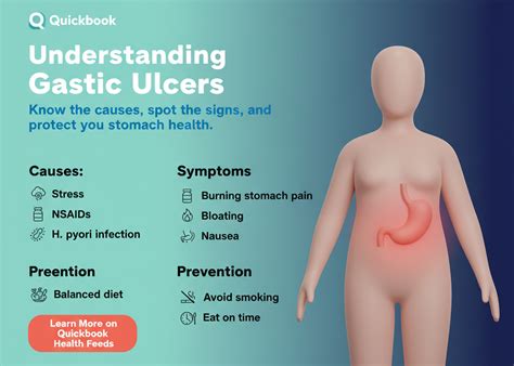 Health Feed Gastric Ulcers Causes Symptoms And Prevention