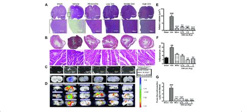 Danhong Injection Reduced Brain Infarct Further And Protected The BBB