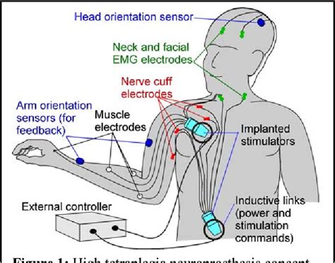 Figure 1 From Development Of A Neuroprosthesis For Restoring Arm And Hand Function Via